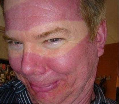 World's Worst Tanning Disasters