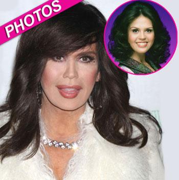 Plastic Fantastic? Marie Osmond Has ‘Undergone A Startling ...