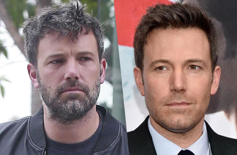 Facelifts! Botox! Stars With Freaky Faces After Botched Plastic Surgery ...