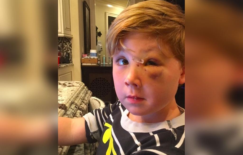 [PICS] Kim Zolciak Gives Update On Kash Biermann’s Dog Bite During Vacation