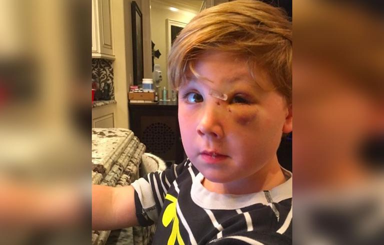 [PICS] Kim Zolciak Gives Update On Kash Biermann’s Dog Bite During Vacation