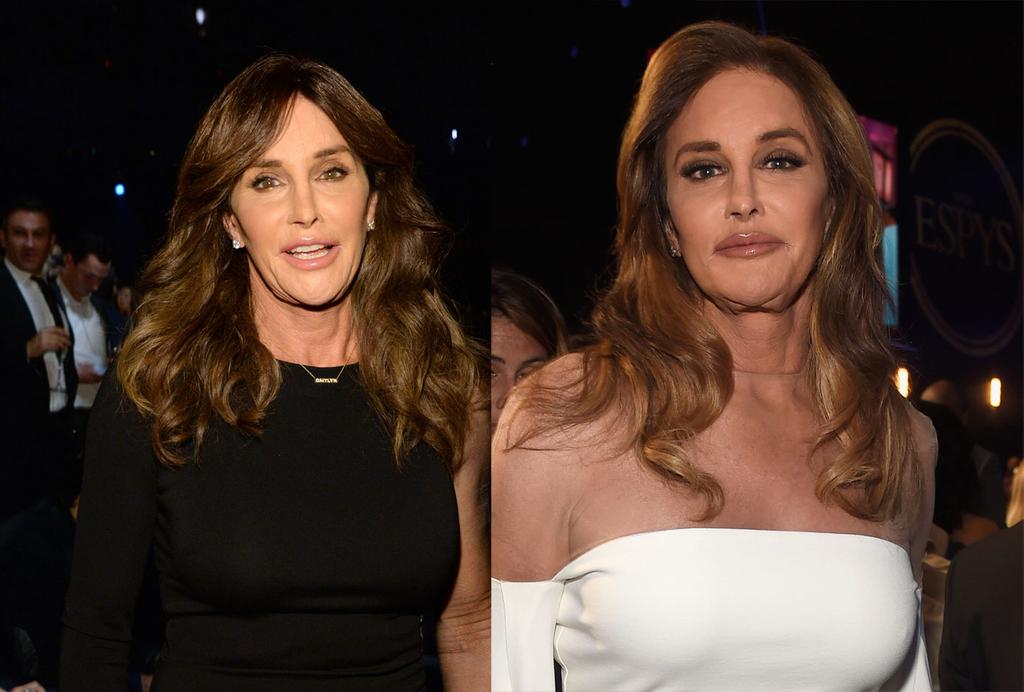 Halloween In Hollywood! Scariest Celeb Plastic Surgery Nightmares of 2017