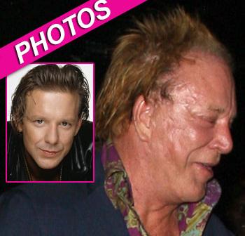 Mickey Rourke | Radar Online