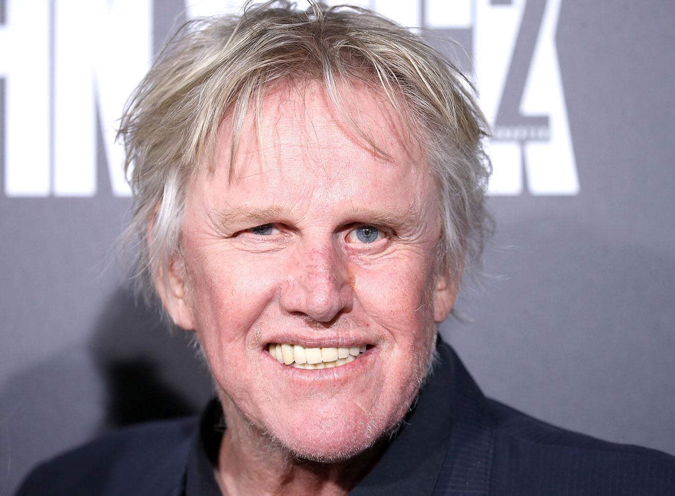 Gary Busey Admits Plastic Surgery Makeover In New Tell-All Book