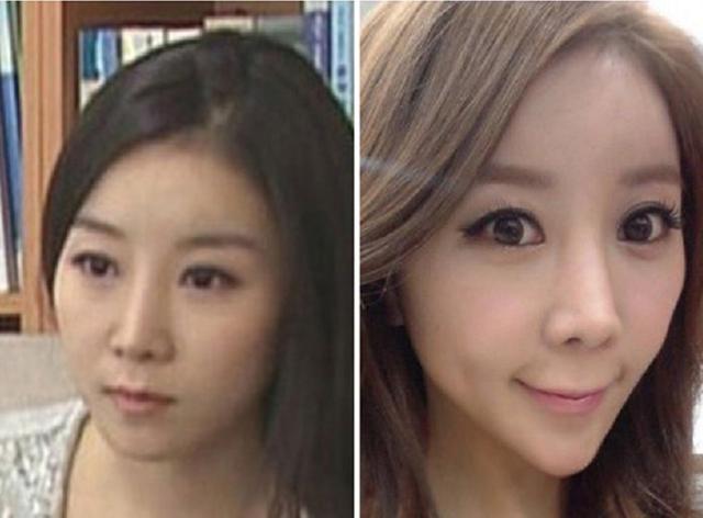 15 Extreme Real Life Plastic Surgery Disasters