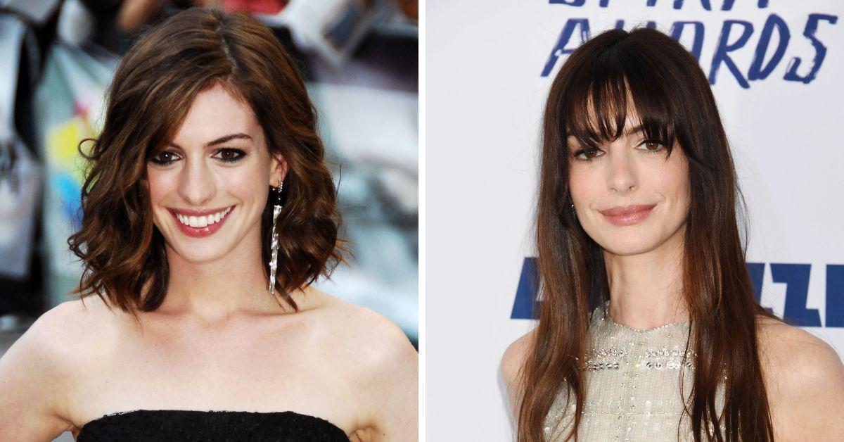 Stars Who Got Nose Jobs