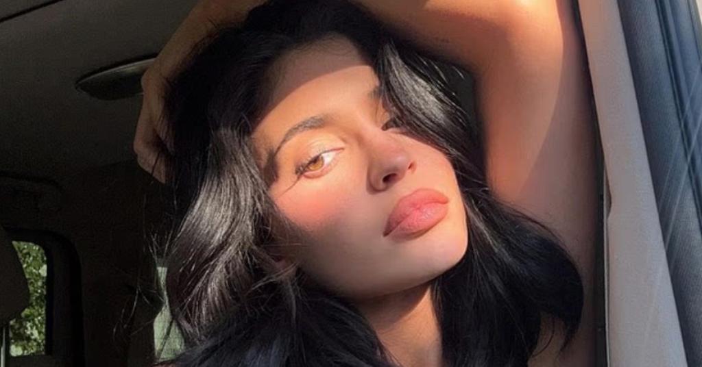 Amanda Bynes Unveils Stunning New Look After Getting Lip Fillers