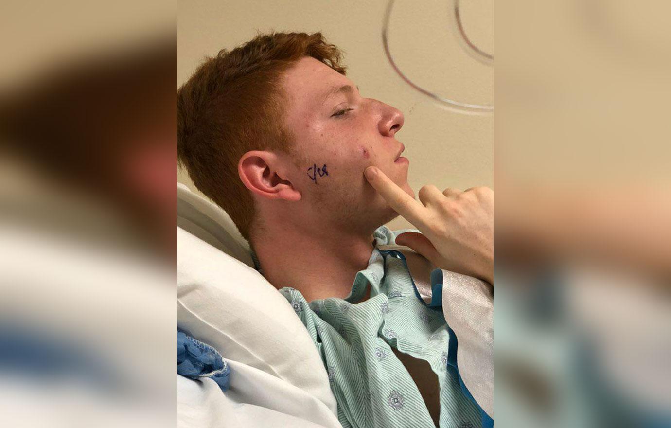 '90 Day Fiancé' Star Surgery Complications Bullet Shot Face Graphic Photos