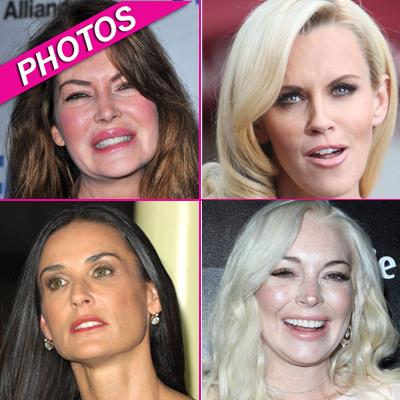 Overly Botoxed Babes? 10 Celebrities With Frozen Faces!