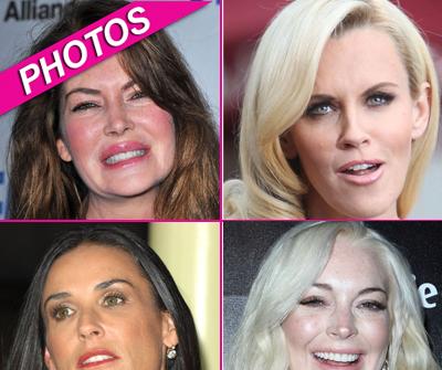 Overly Botoxed Babes? 10 Celebrities With Frozen Faces!