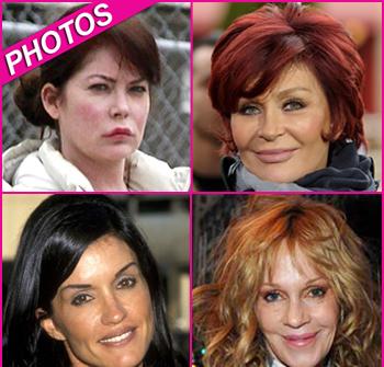 Obsessed With Plastic Surgery! 10 Celebrities Who Can’t Stop Going ...