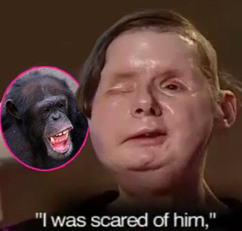 Blinded Chimp Attack Victim Will Get Her Day In Court, Suing State Of ...