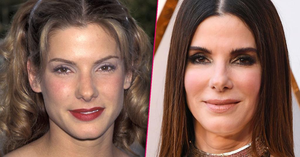 Sandra Bullock Fillers Puffy Cheek Fail