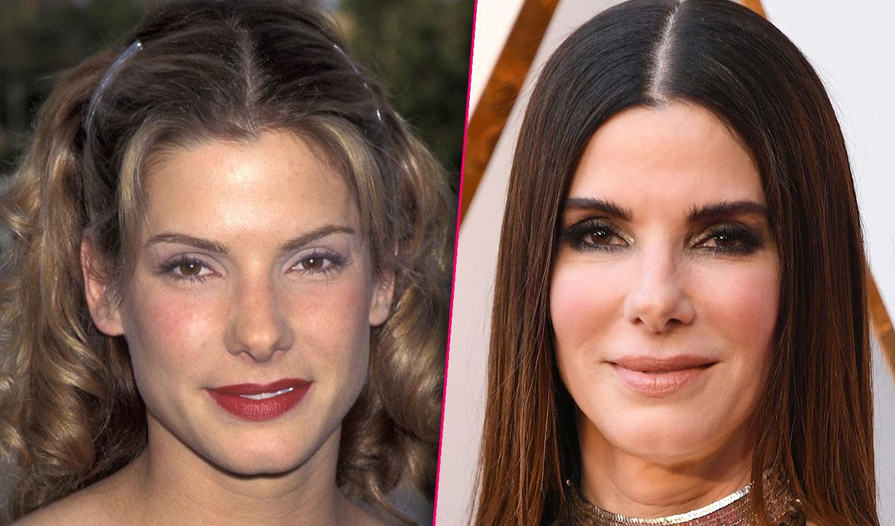 Sandra Bullock Fillers Puffy Cheek Fail