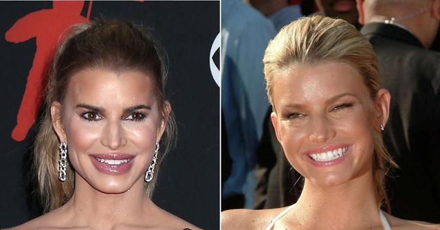 Plastic Surgeon Reveal Secrets Behind Jessica Simpson's New Face