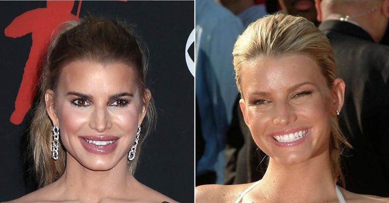 Plastic Surgeon Reveal Secrets Behind Jessica Simpson's New Face