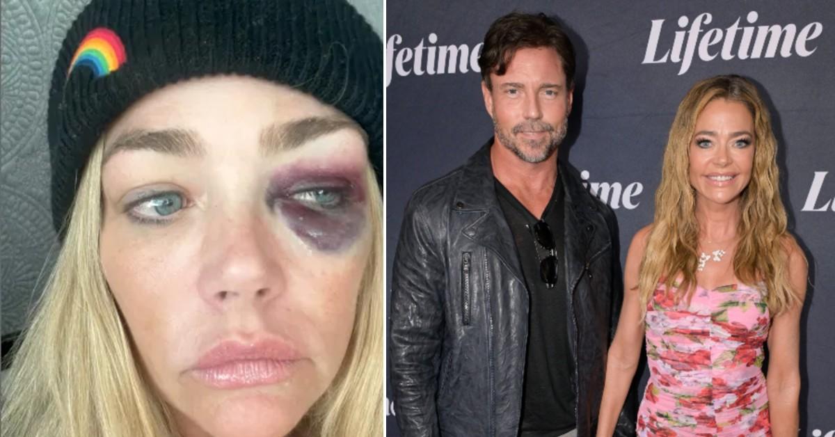 Denise Richards Granted Restraining Order Against Ex Aaron Phypers