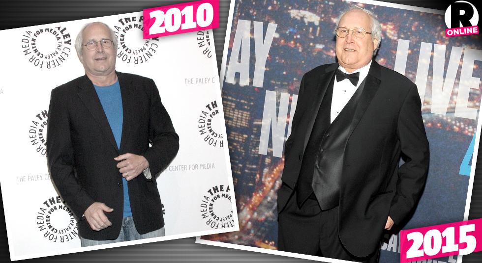 Chevy Chase's Shocking Weight Gain, Top Expert Claims It May Be From ...
