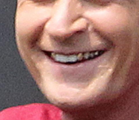 Charlie's Skin Appears To Show His Struggle With Deadly Disease