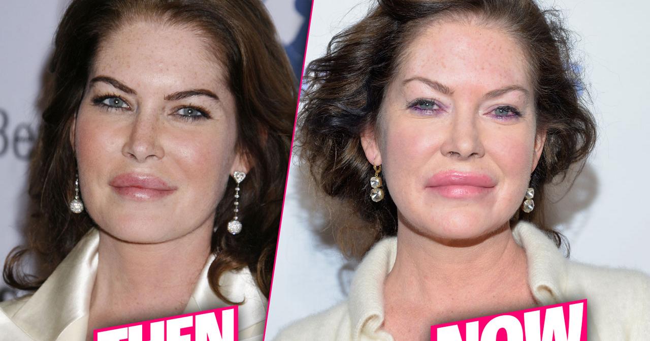 Lara Flynn Boyle Is Puffy & Unrecognizable On Gala Red Carpet Lara Flynn Boyle Is Puffy & Unrecognizable On Gala Red Carpet