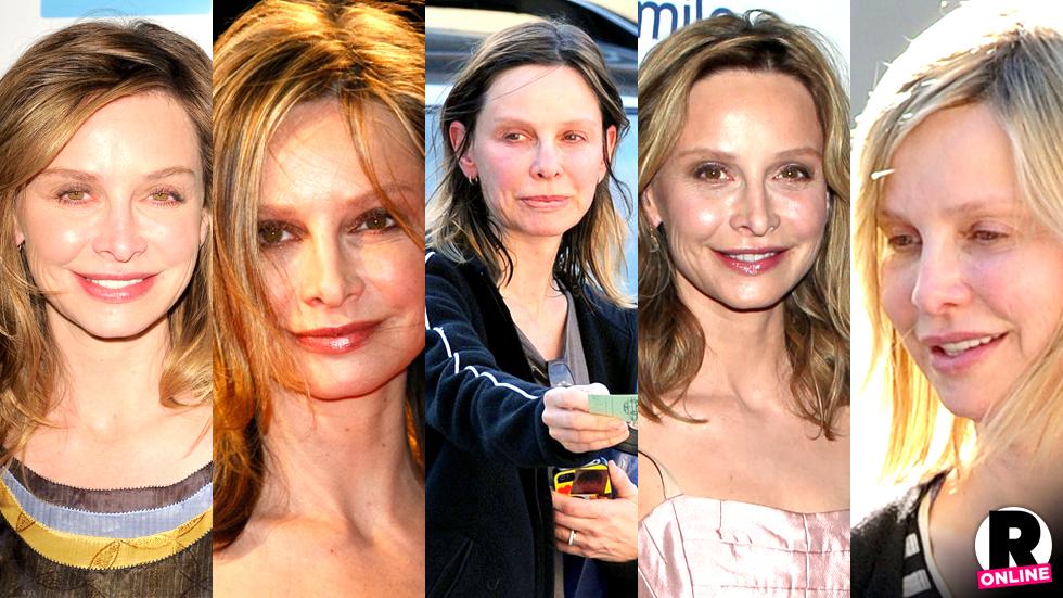 Calista Flockhart Facelift! Top Docs Reveal She Had Secret Plastic Surgery