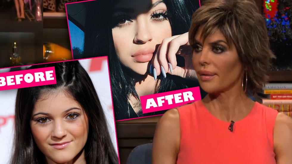 Lisa Rinna Thinks Kylie Jenner Has Had Lip Injections