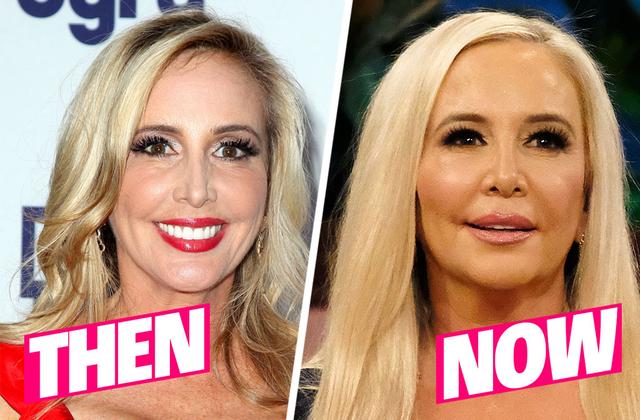 'RHOC' Cast Plastic Surgery Transformations Exposed Top Docs