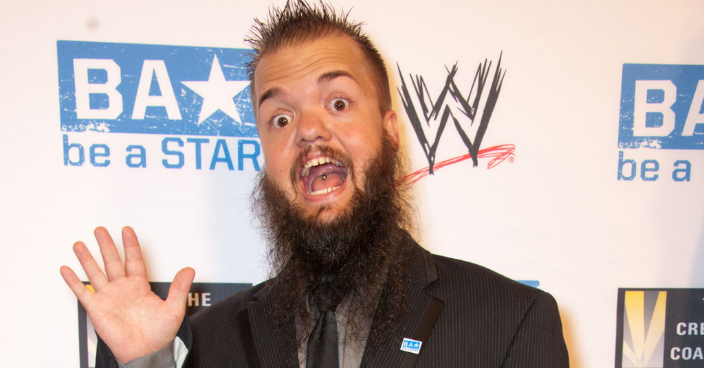 Peter Dinklage Bashed By Dwarf Actors, Claim He Put Them 'Out Of A Job'