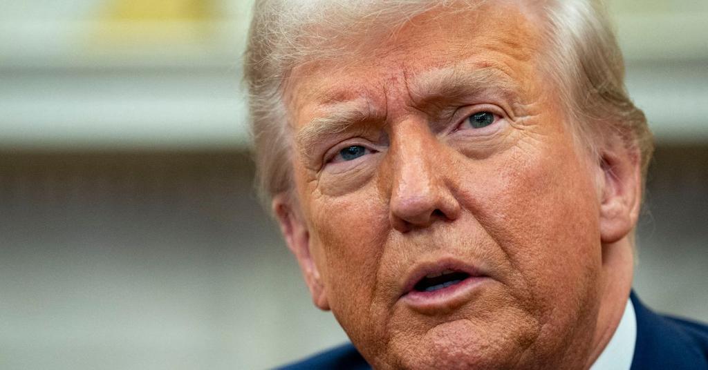 Donald Trump Sparks Health Fears By Sporting Heavily Bruised Hand