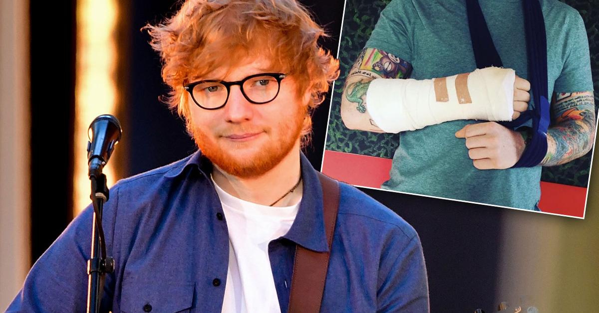 Ed Sheeran Gets Hit By Car, Break Arm Days Before Asia Tour!