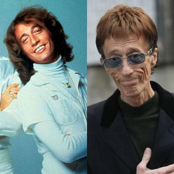 Bee Gees Robin Gibb Looks Shockingly Sick & Gaunt