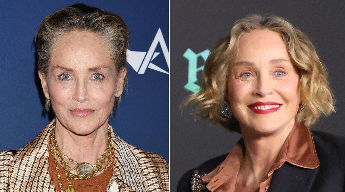 Sharon Stone's 'New Face' Explained With 'Volumizing Treatments'