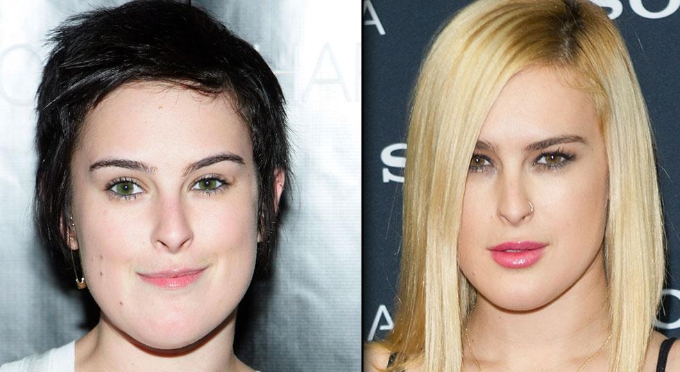 Did Rumer Willis Have Her Chin Shaved Down? Top Plastic Surgeon Reveals ...