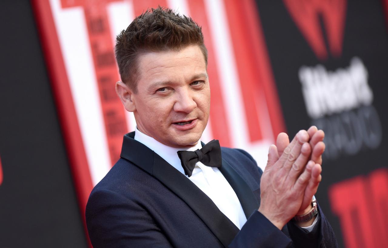 Famous Flaws! The Top 35 Celebrity Deformities