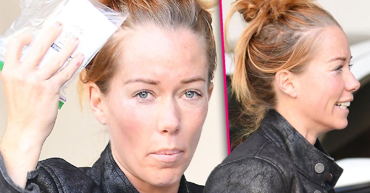 Kendra Wilkinson Gets Botox After Split From Hank