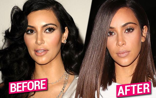 Secret Chin, Nose & Lips Surgery — Kim K's Drastic Plastic Obsession ...