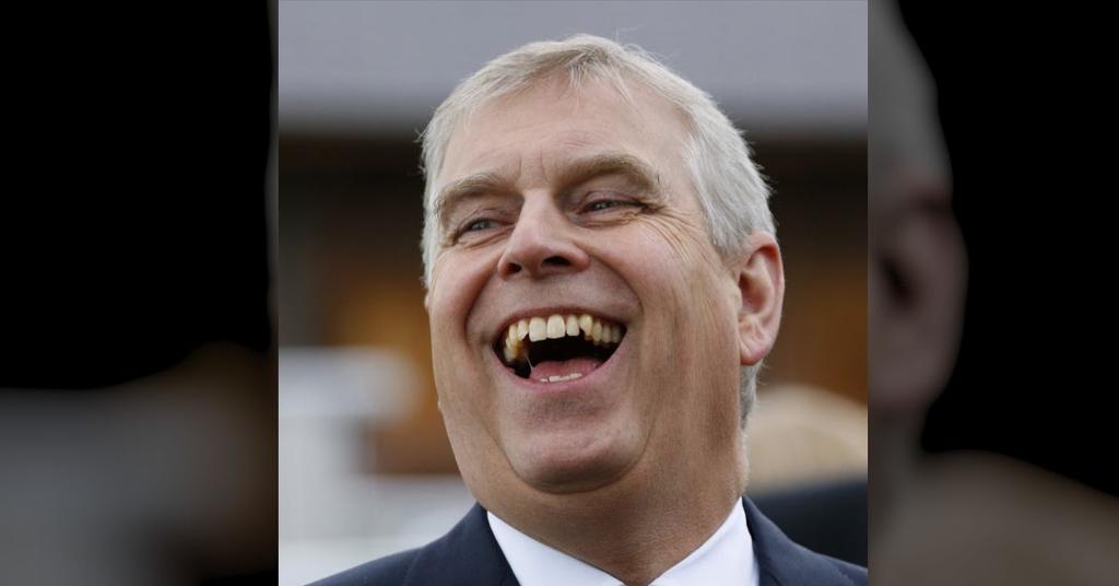 Andrew Windsor Face Bruise Sparks Assault And Dementia Fears