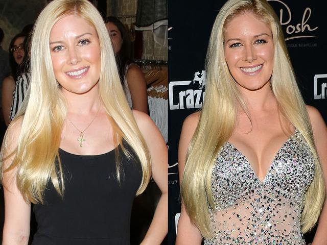 Ariel Winter Isn't Alone! 10 Stars Who Have Had Breast Reduction ...