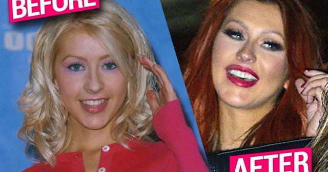 Fillers, Implants & More! Christina's Face Is More Plastic Than Ever ...