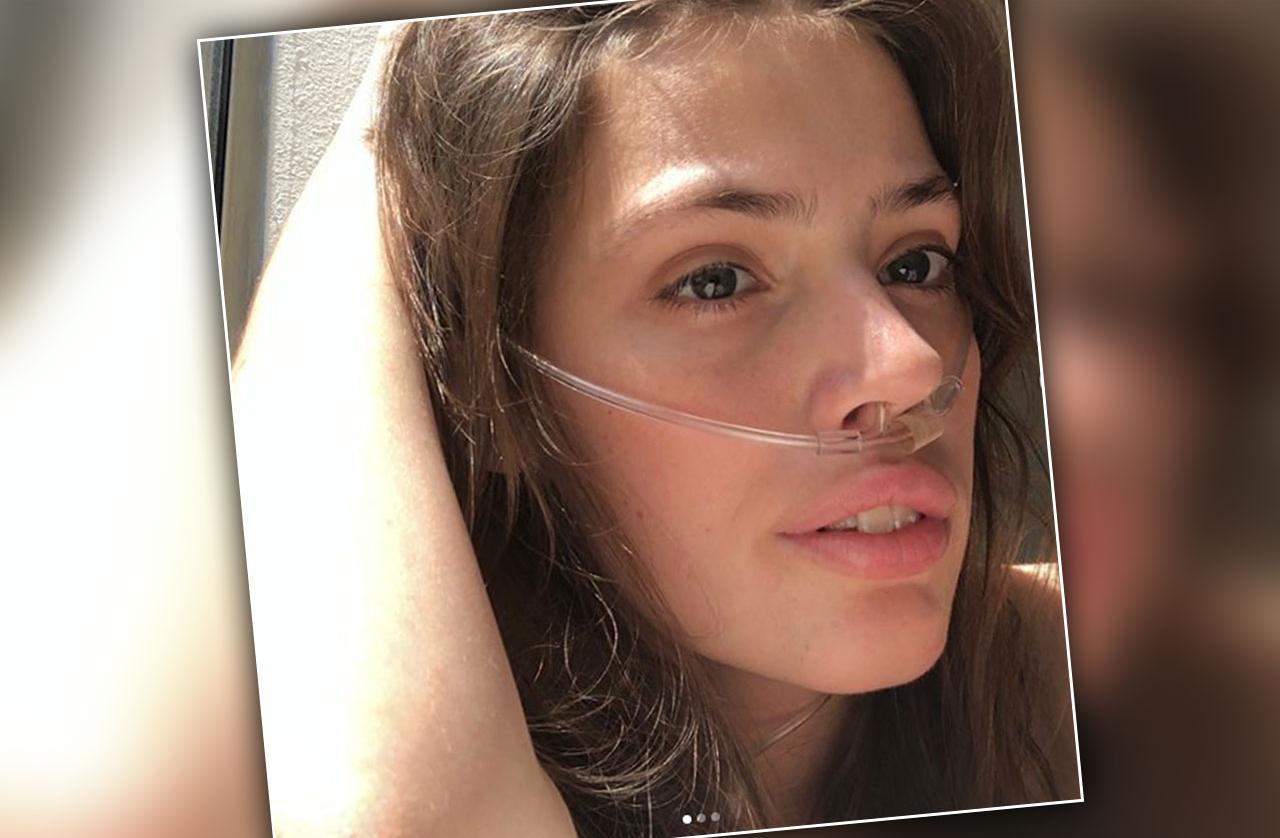 Social Media Star Claire Wineland Dead After Undergoing Lung Transplant