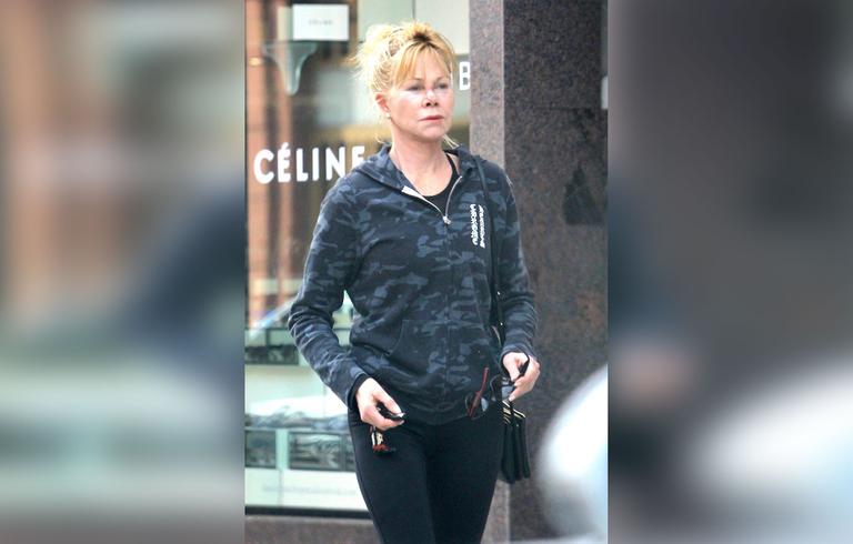 Melanie Griffith Wears Nose Bandage After Skin Cancer Treatment