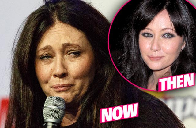 Shannen Doherty Reveals Wrinkled New Face — Inside Her Tragic Health ...