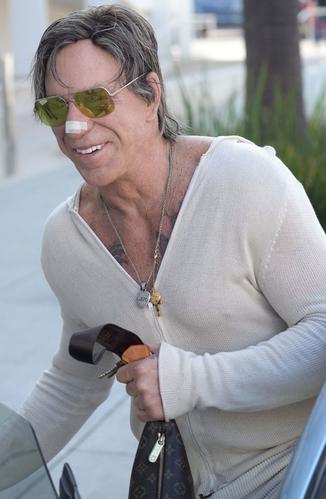 More Time Under The Knife For Mickey? Rourke Sports Bandaged Nose In 8 ...