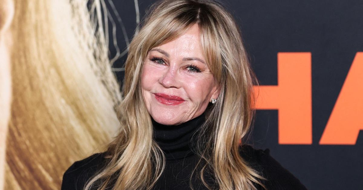 Melanie Griffith Displays Bruised Face and Hand After Skin Cancer Battle
