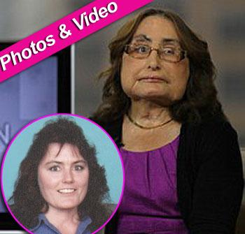 Face Transplant Woman Tells Anderson Cooper Why She Finally Divorced ...