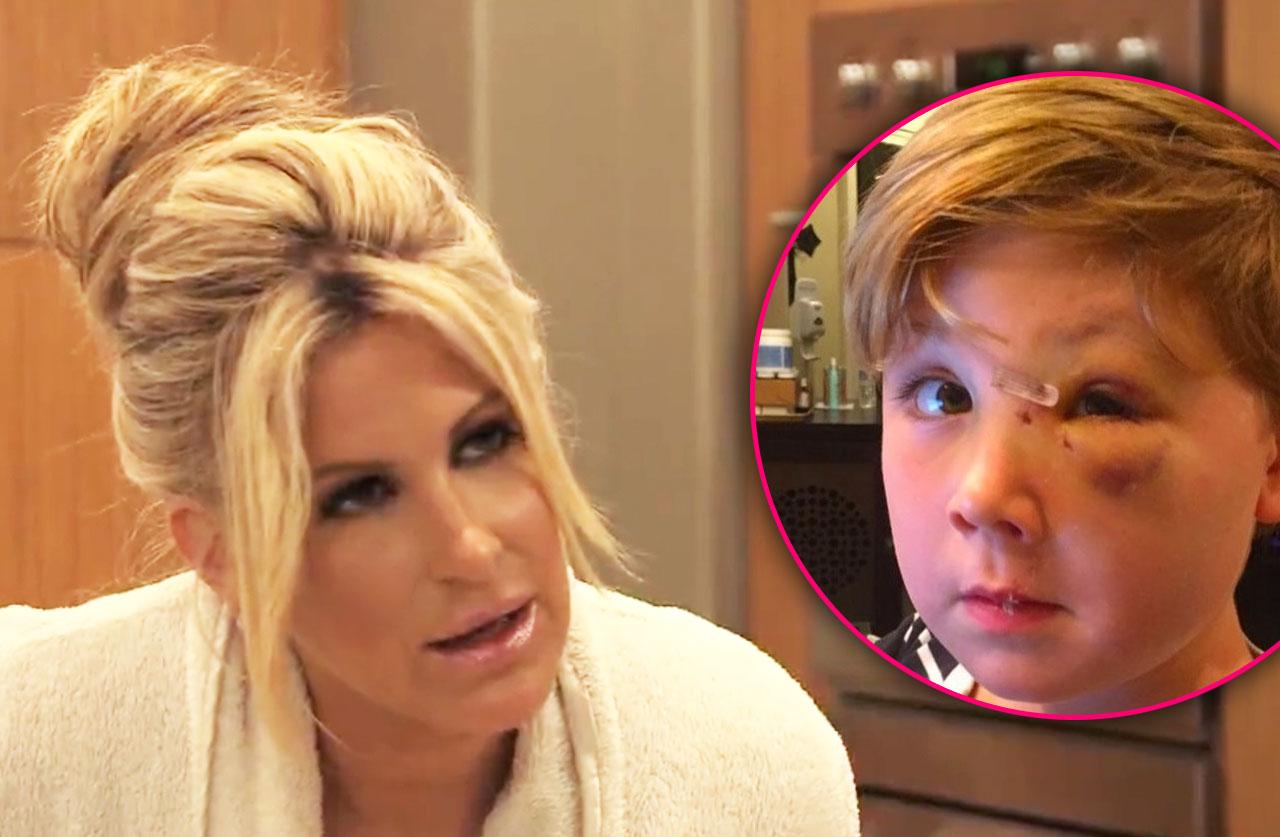 [VIDEO] Kim Zolciak’s Son Kash Biermann Plays With Animals & Visits Plastic Surgeon After ...