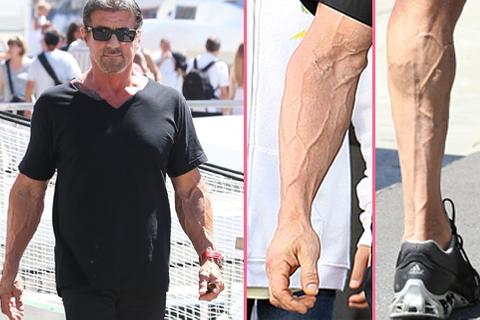 They’re So Vein! Look 13 Celebs Whose Veins Pop Out And Stay Out! See ...