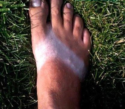 World's Worst Tanning Disasters