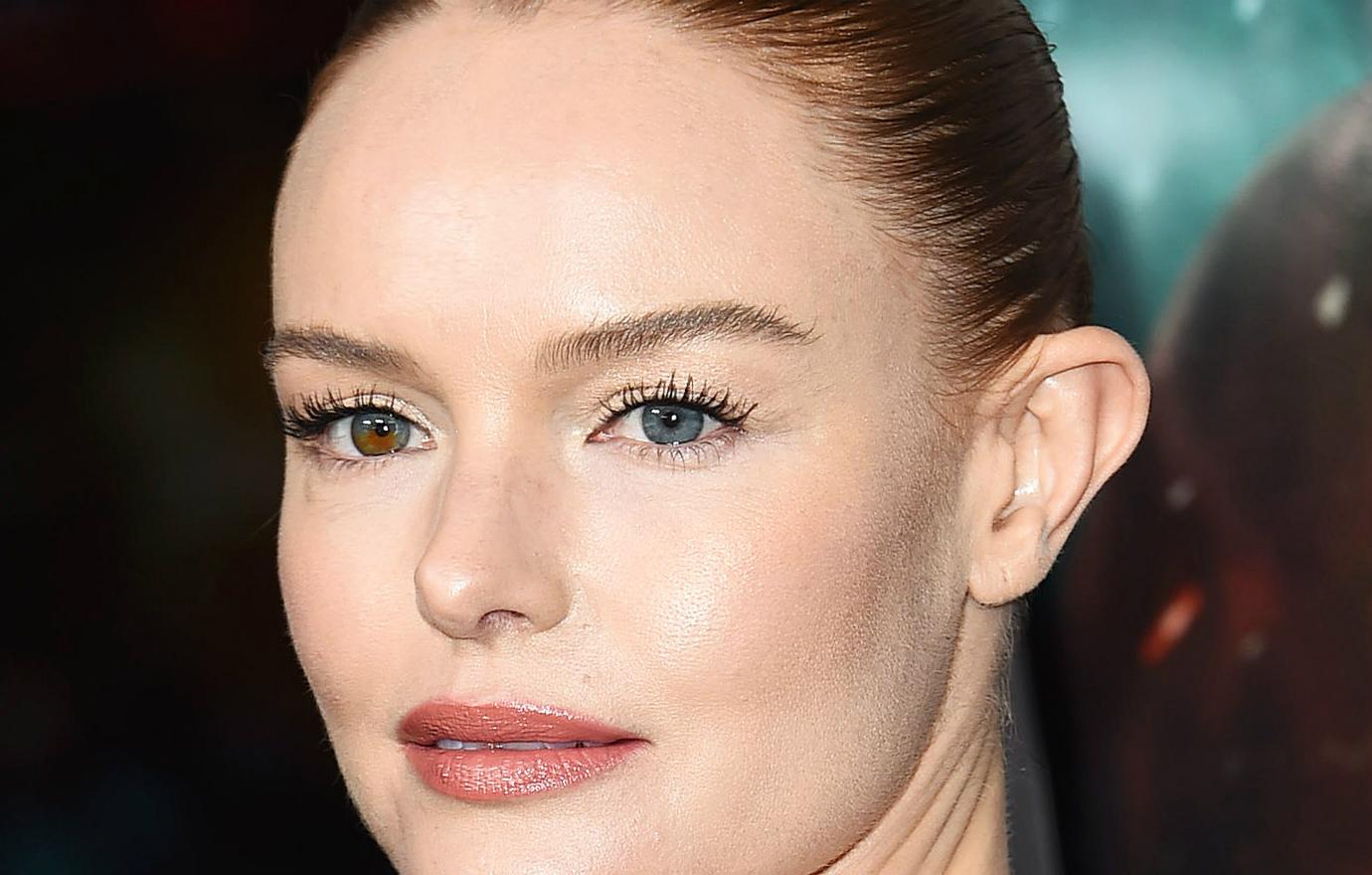 Famous Flaws! The Top 35 Celebrity Deformities