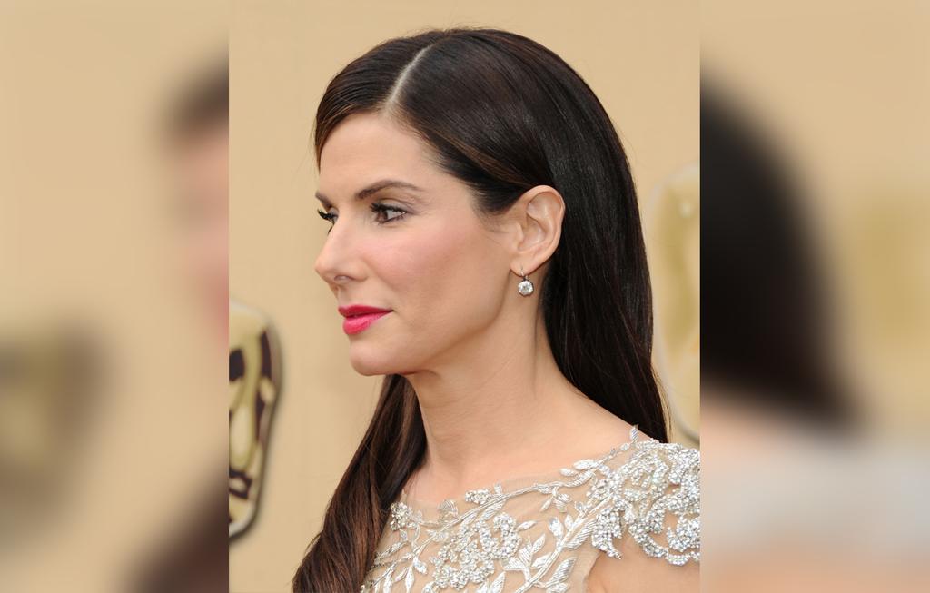Sandra Bullock Frozen Face Result Of 'Fillers & Botox' Overload, Docs Claim